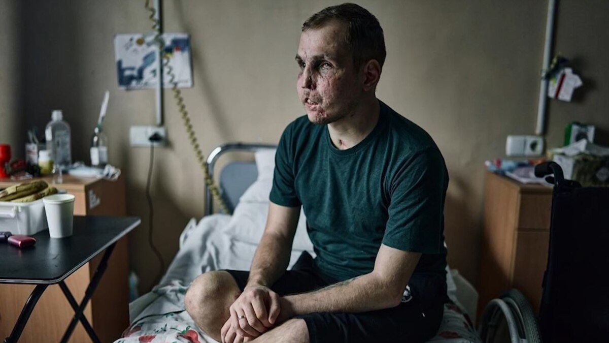 With No Legs And No Sight, A Ukrainian Soldier Strives To Walk And See ...