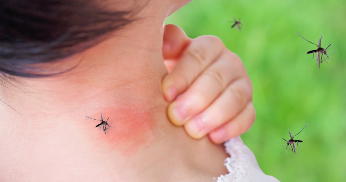 Înțepăturile de insecte: când devin periculoase și cum ne protejăm