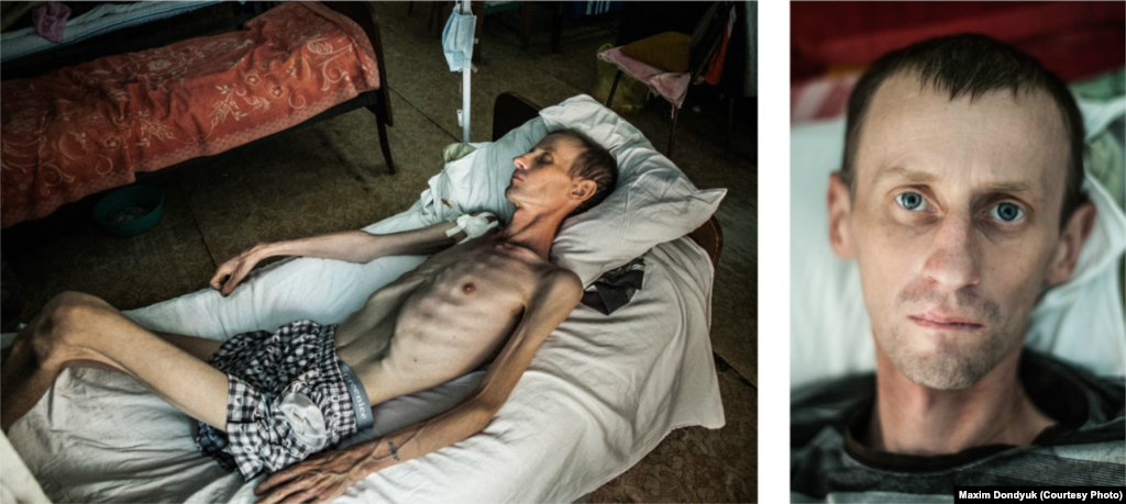 The Faces Of Tuberculosis